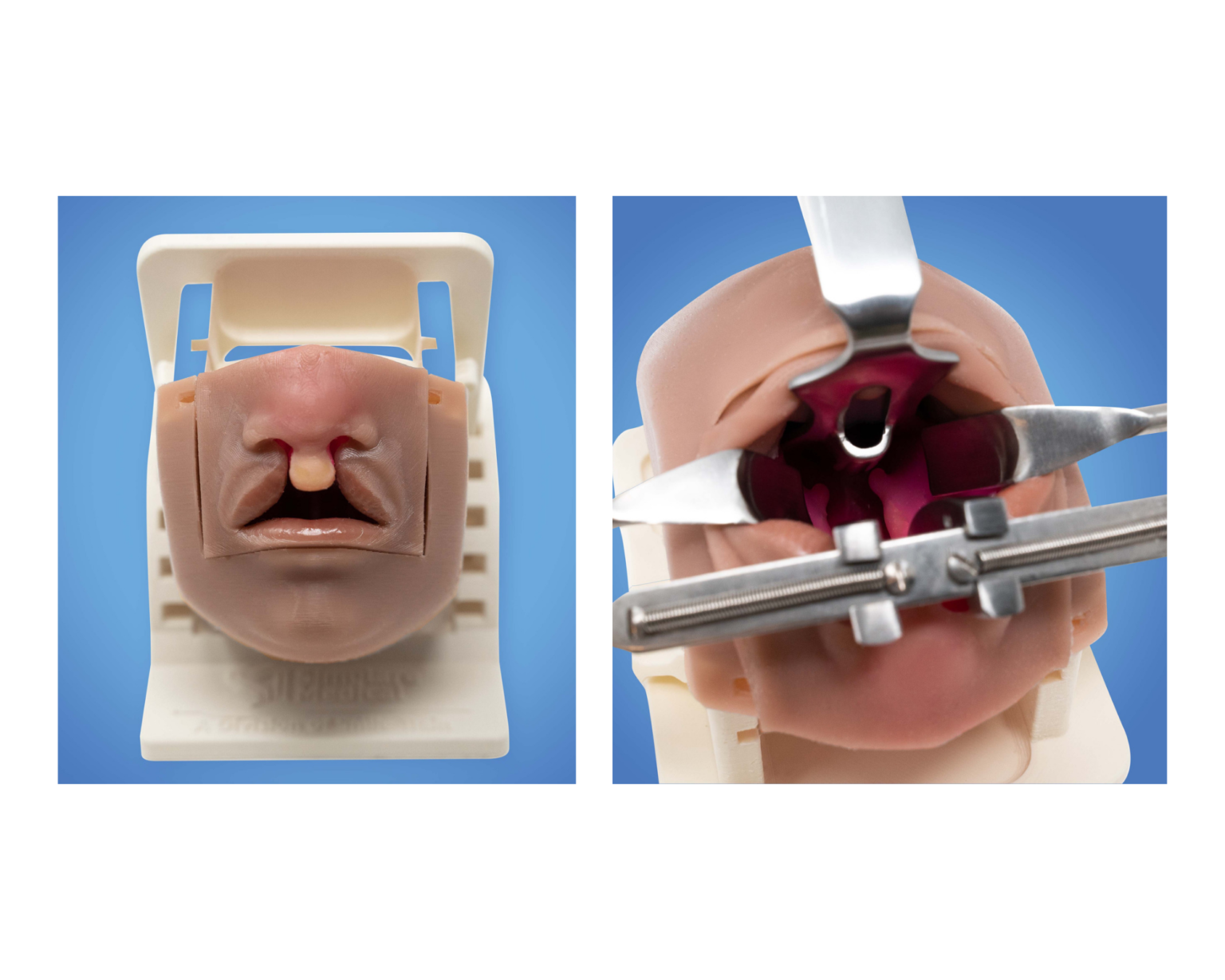 Simulare Medical, a Division of Smile Train, Announces Patent-Pending ...